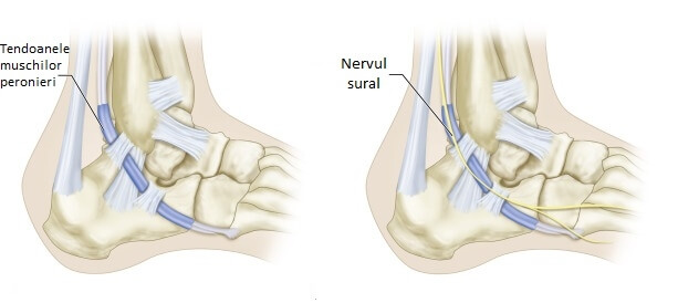 Treatment Of Peronier Tendon Instability | CENTROKINETIC