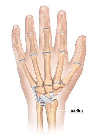 Cura chirurgicala a fracturii de radius | CENTROKINETIC