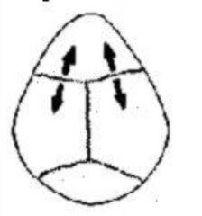 Tipuri de craniostenoze: cauzele aparitiei si consecinte | Centrokinetic