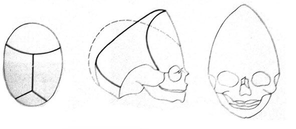 Tipuri de craniostenoze: cauzele aparitiei si consecinte | Centrokinetic