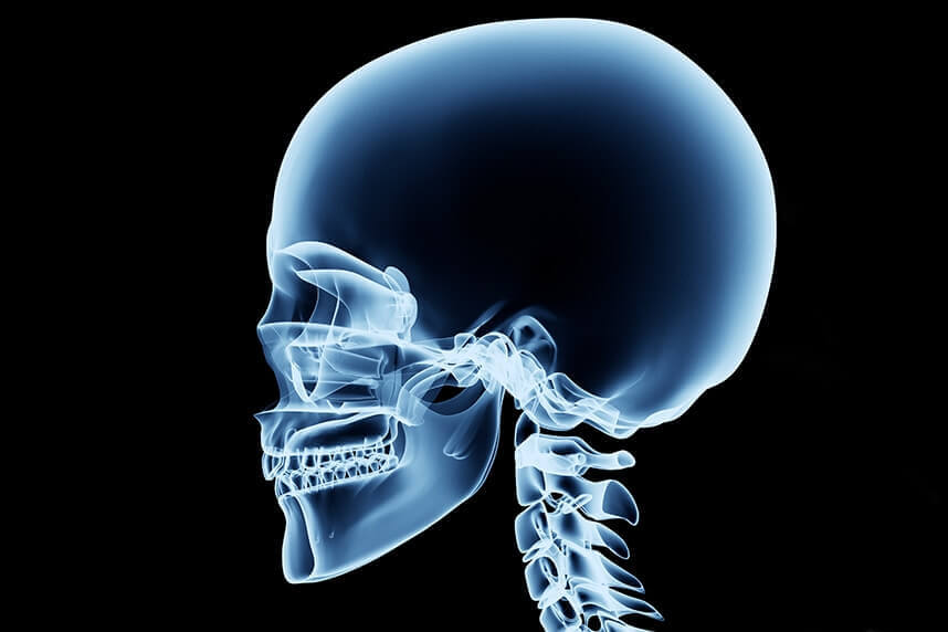 Tipuri de craniostenoze: cauzele aparitiei si consecinte | Centrokinetic