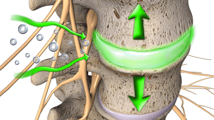 Banca terapeutica pentru elongarea coloanei vertebrale, stretching ...